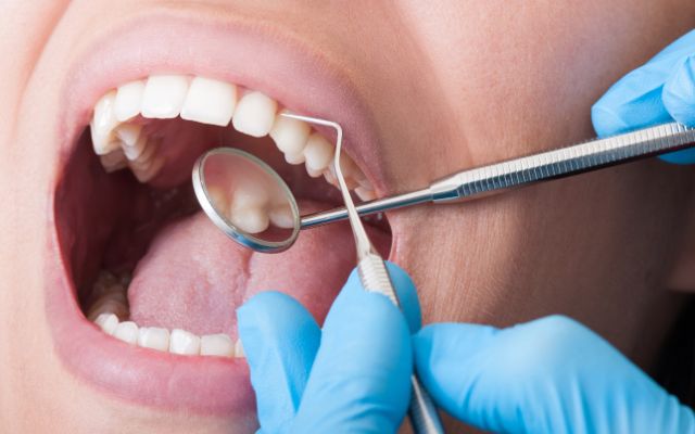Malaga Wa Dentist Spring Orchid Dental Call Us 0861558999